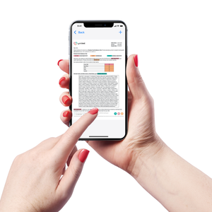 York Test Premium Food Intolerance Test + Consultation – MicroBio Health™